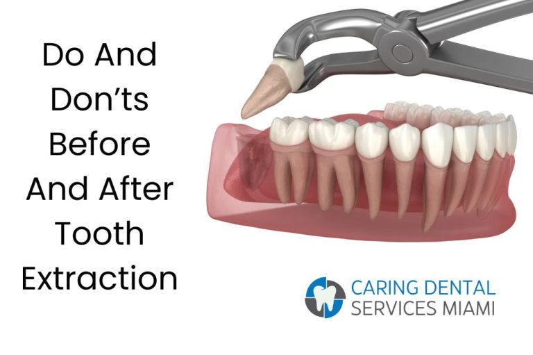 Do And Don’ts Before And After Tooth Extraction - Caring Dental Services